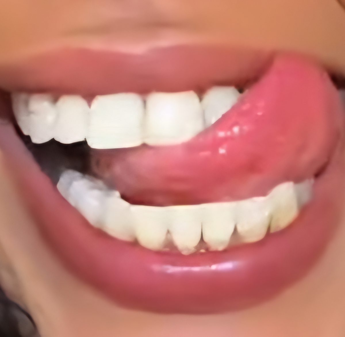 Serge Letchimy...peux-tu au coeur de la démocratie économique...nous ...